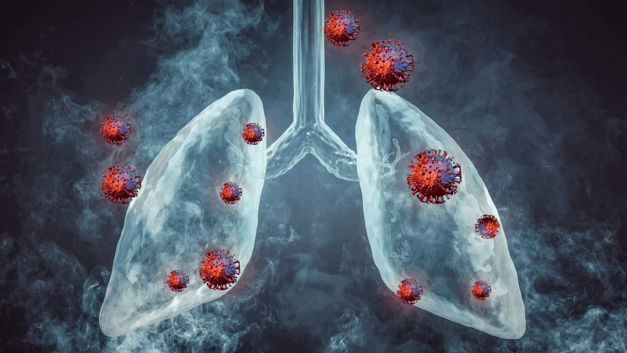 What Is Bronchitis & Why Some Get It More Often